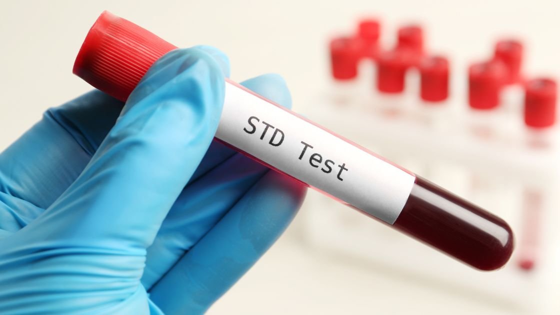 Essential STD Testing Guide: Learn Screening Options Today