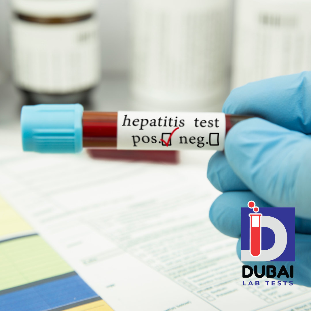 Comprehensive Hepatitis Screening Panel Test. Fast & Accurate Results ...