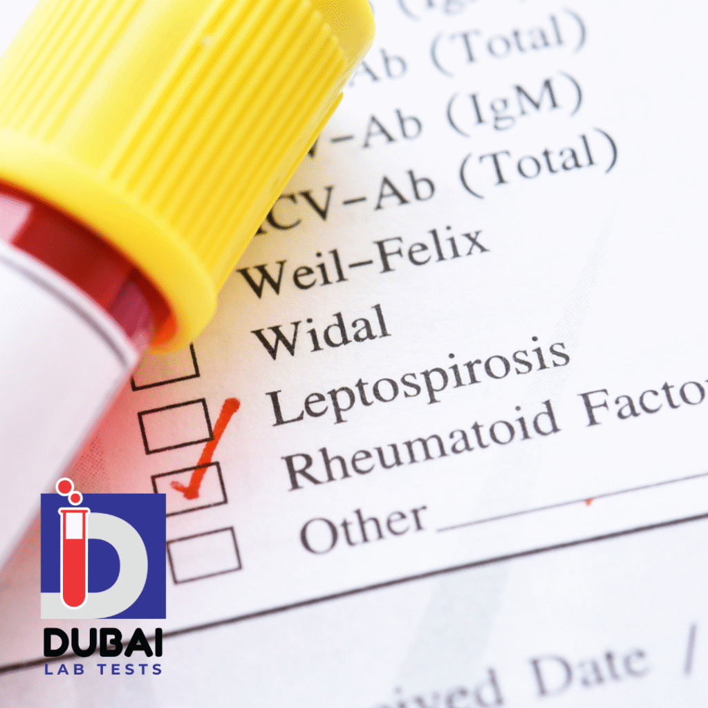 Rheumatoid Factor (RF) Titer Test – Accurate Autoimmune Blood Testing ...